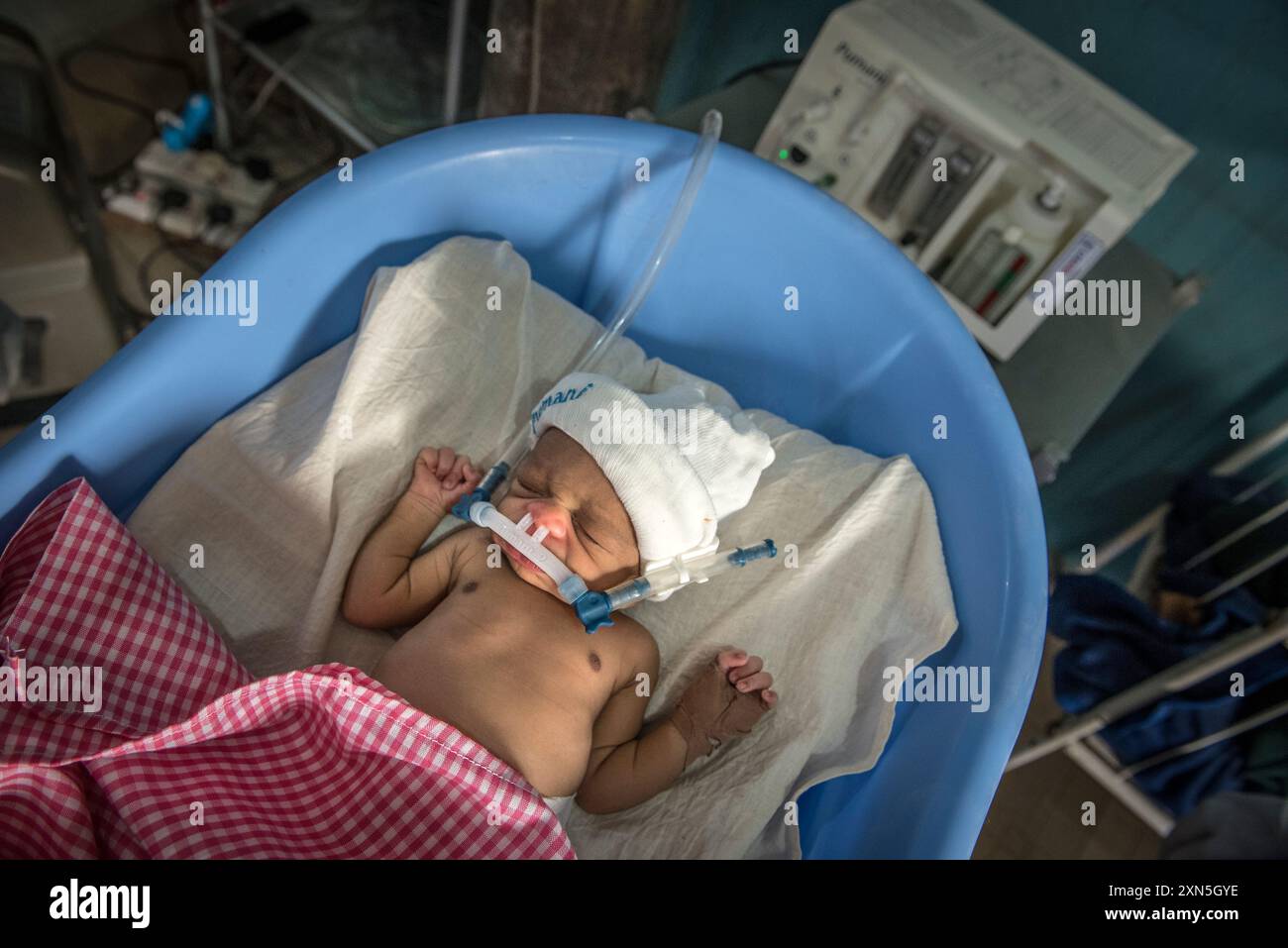 Four day old baby receiving oxygen through a nasal cannula ...