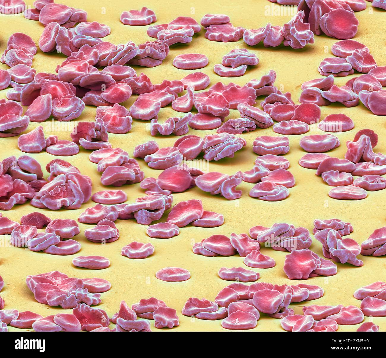 Red blood cells. Coloured scanning electron micrograph (SEM) of red ...