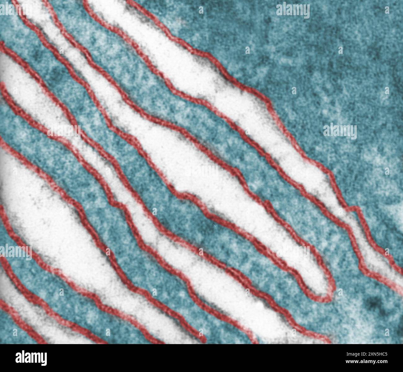 Transmission electron micrograph (TEM) showing the trilaminar structure ...