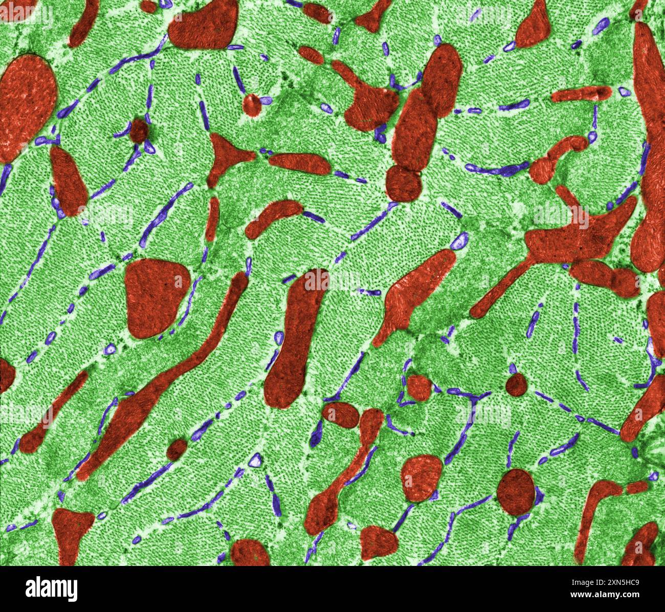 Coloured transmission electron micrograph (TEM) showing a cross-sectioned muscle cell at the A ...