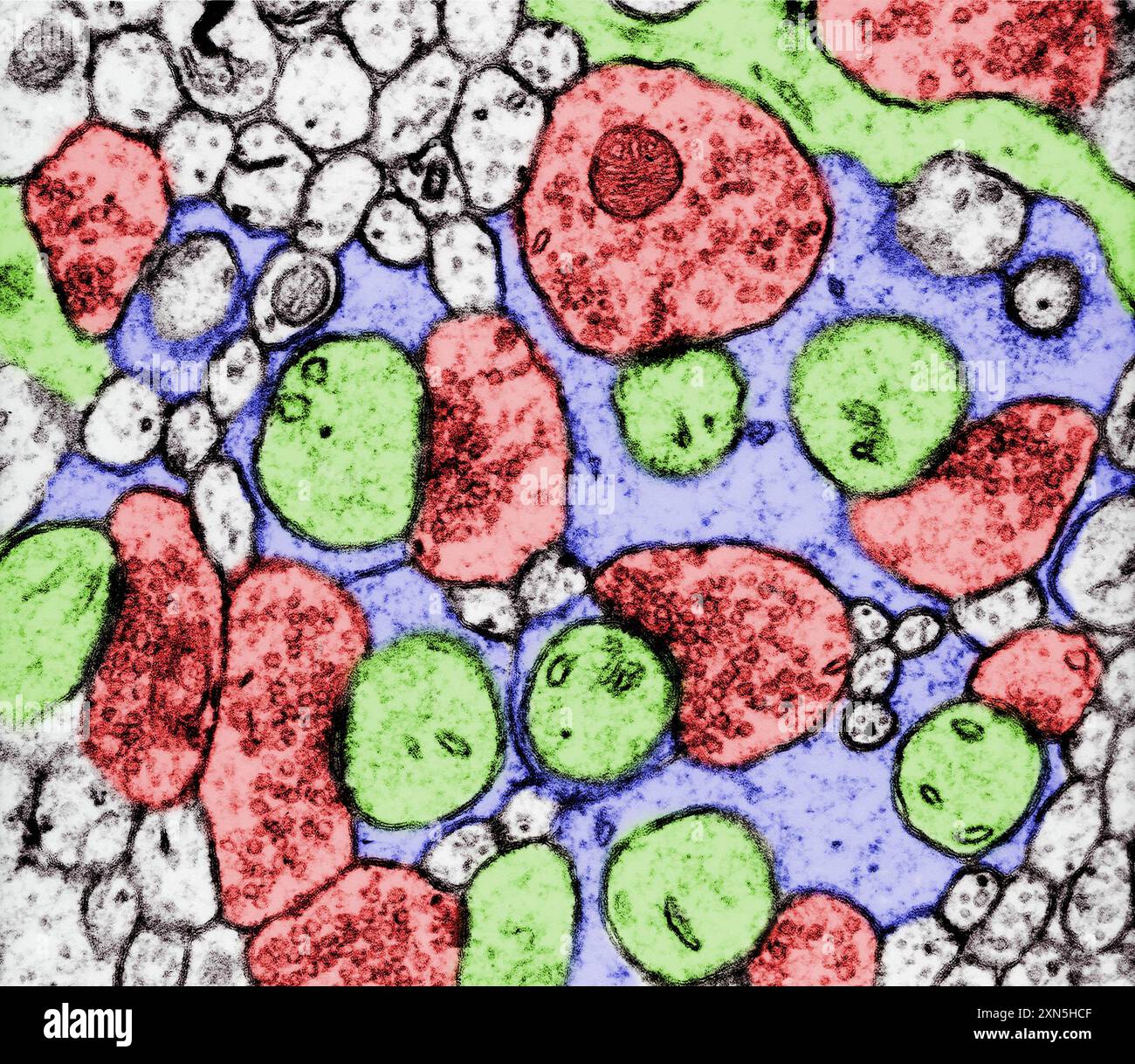 Coloured transmission electron micrograph (TEM) of the cerebellar ...
