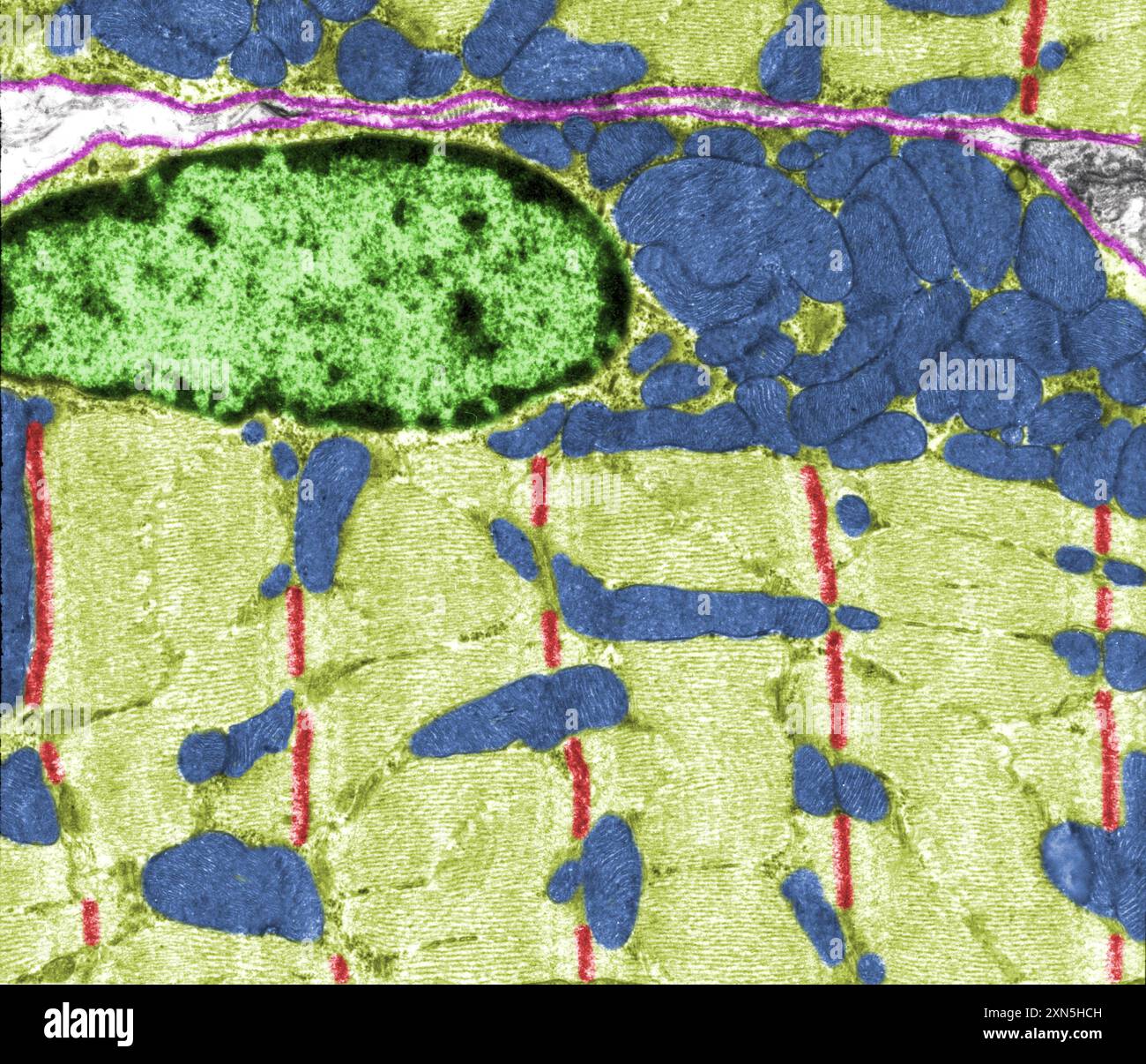 Coloured transmission electron micrograph (TEM) showing a striated muscle fibre surrounded by a ...
