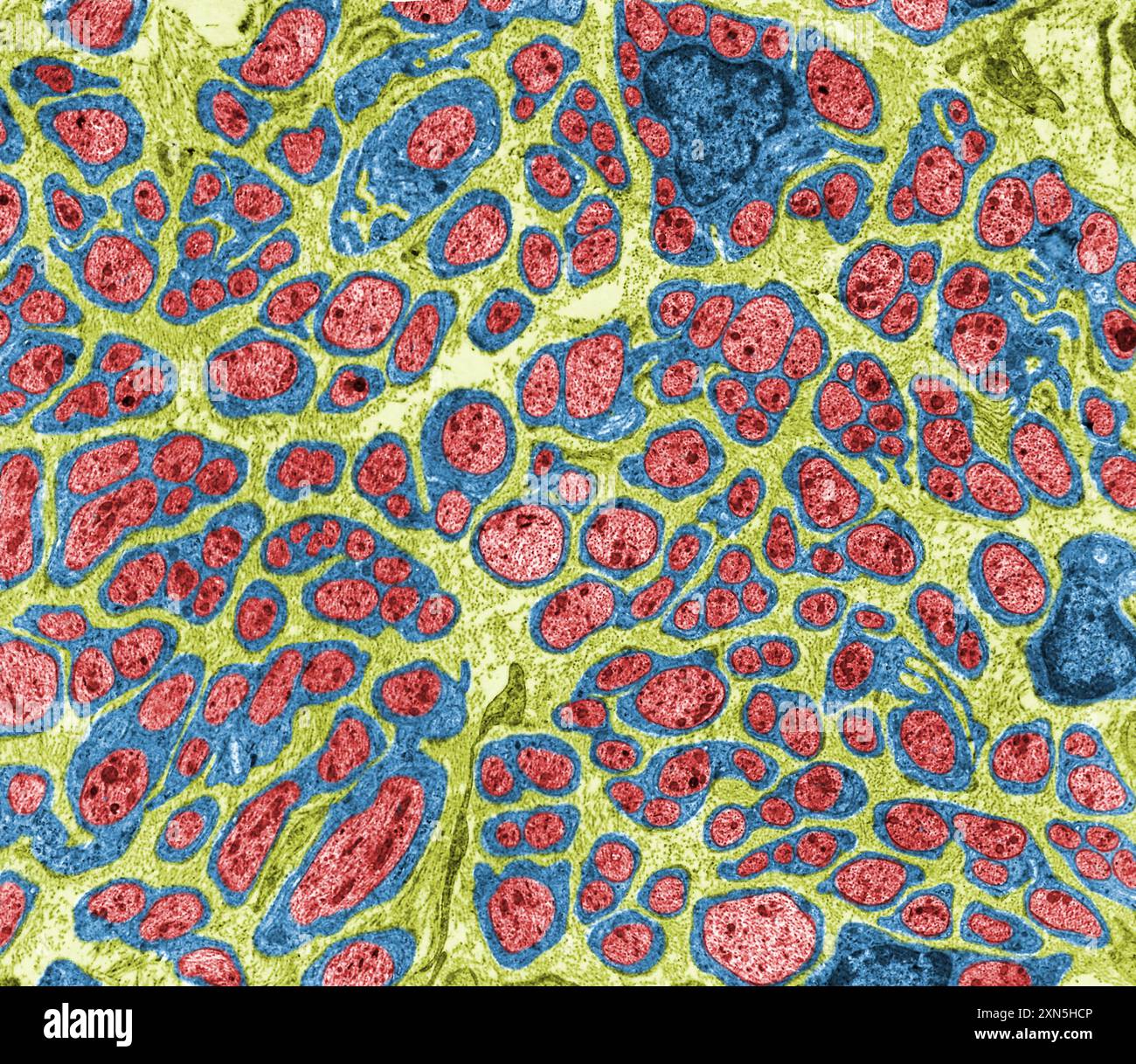 Coloured transmission electron micrograph (TEM) of several peripheral ...