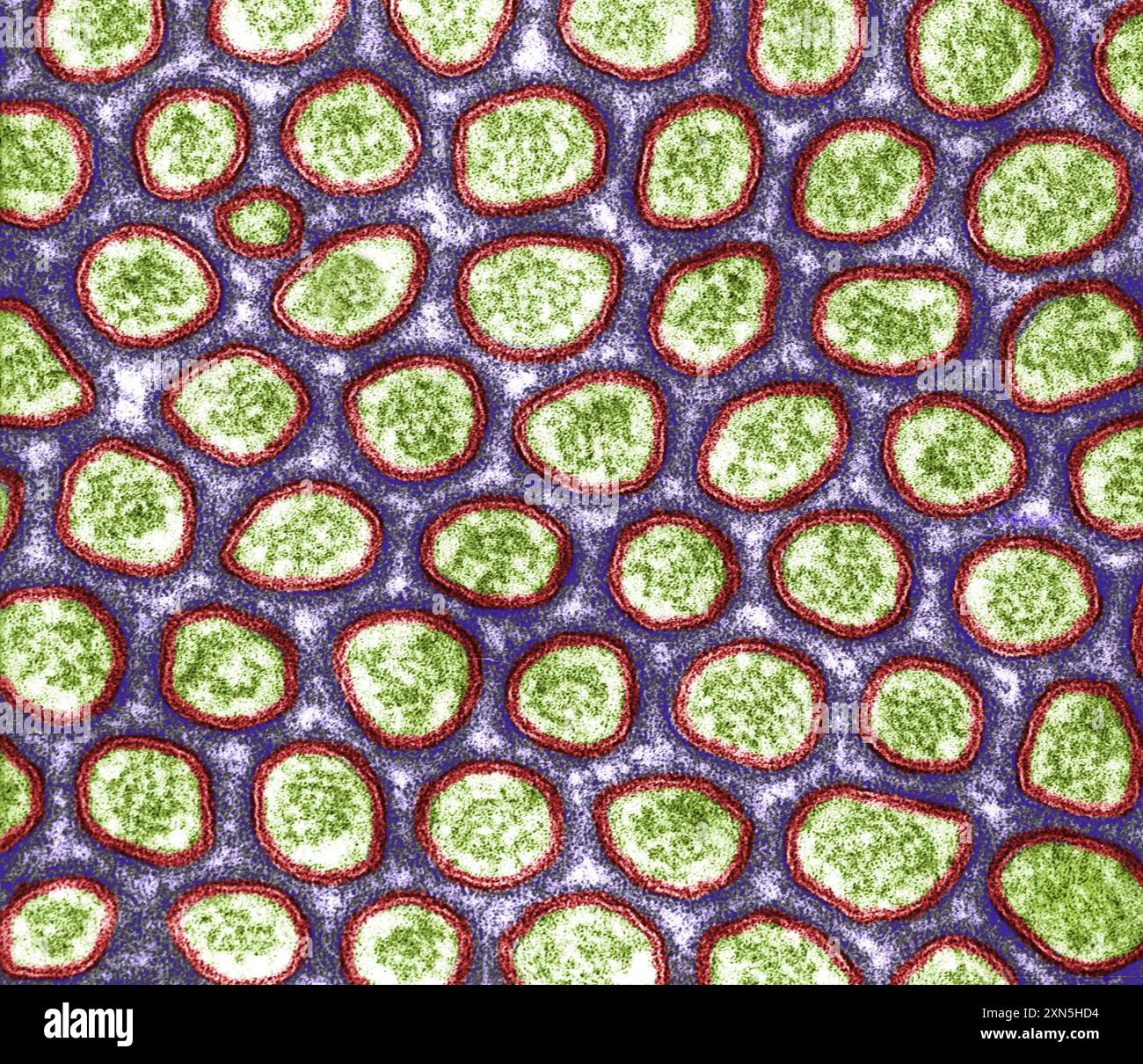 Coloured transmission electron micrograph (TEM) of a cross-sectioned ...