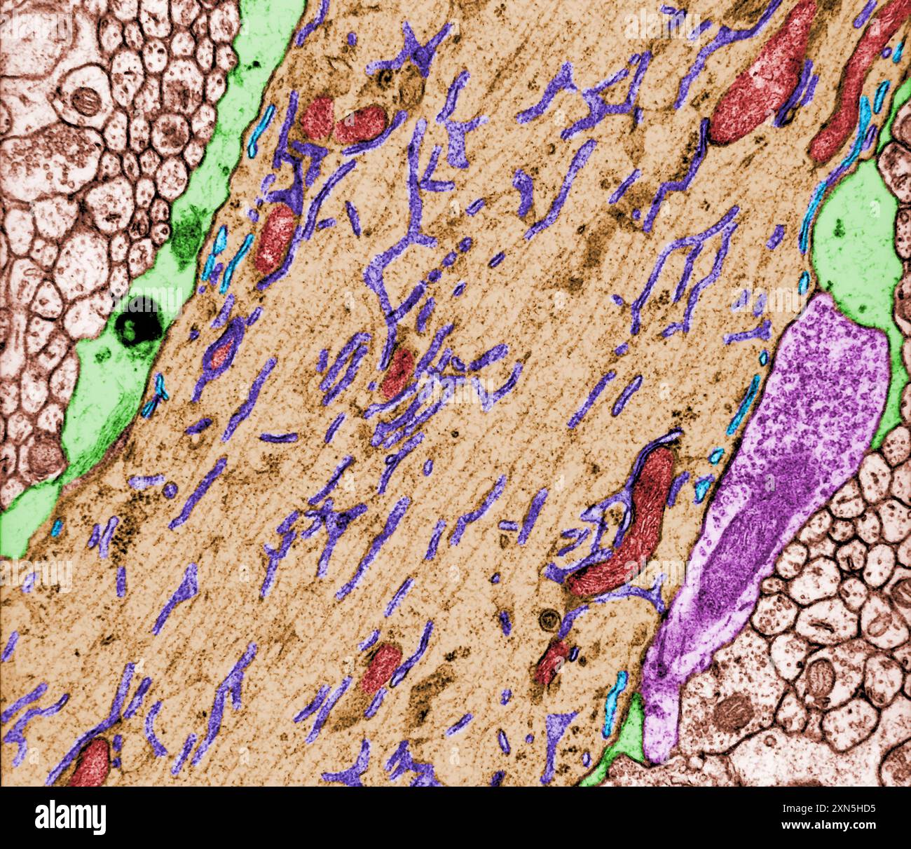 Coloured transmission electron micrograph (TEM) showing a dendrite ...