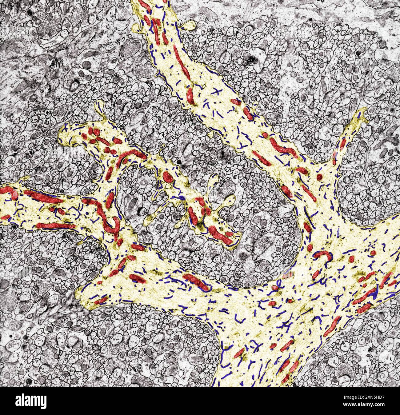 Coloured transmission electron micrograph (TEM) of a Purkinje cell ...