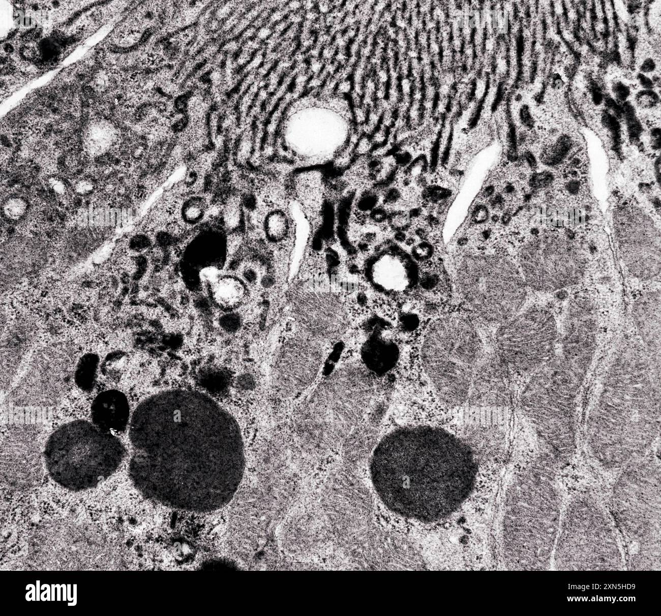 Transmission electron micrograph (TEM) showing the apical region of a ...