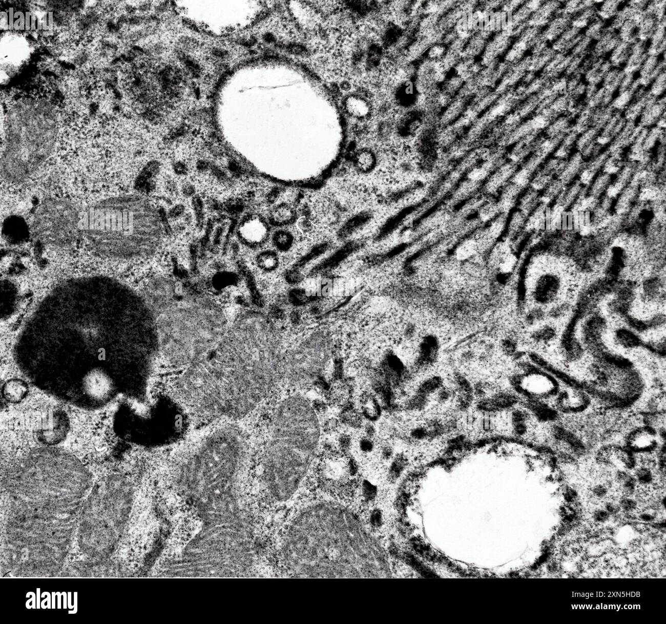 Transmission electron micrograph (TEM) showing the apical region of a ...