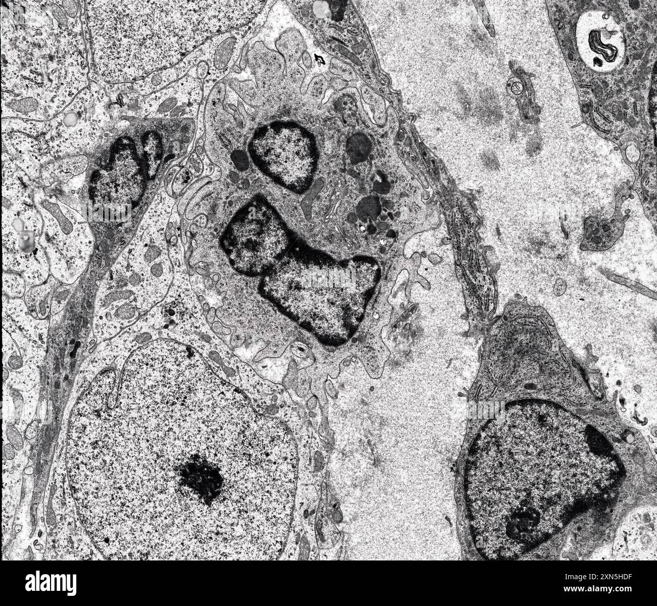 Transmission electron micrograph (TEM) showing a macrophage with many ...