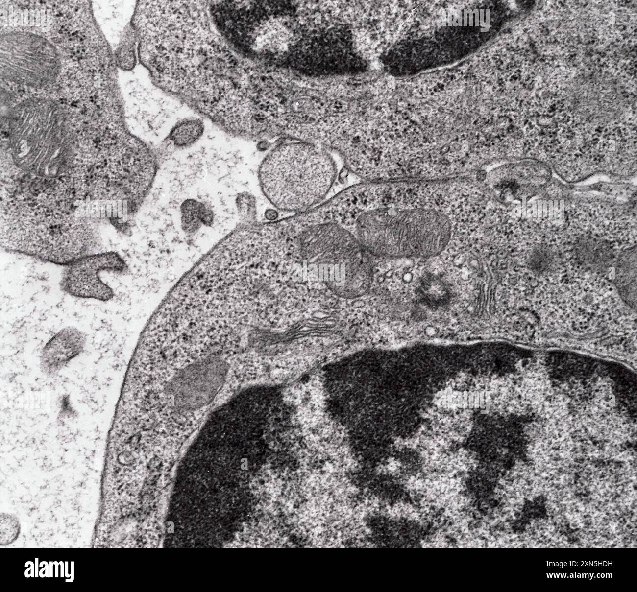 Transmission electron micrograph (TEM) of a lymphocyte cytoplasm ...