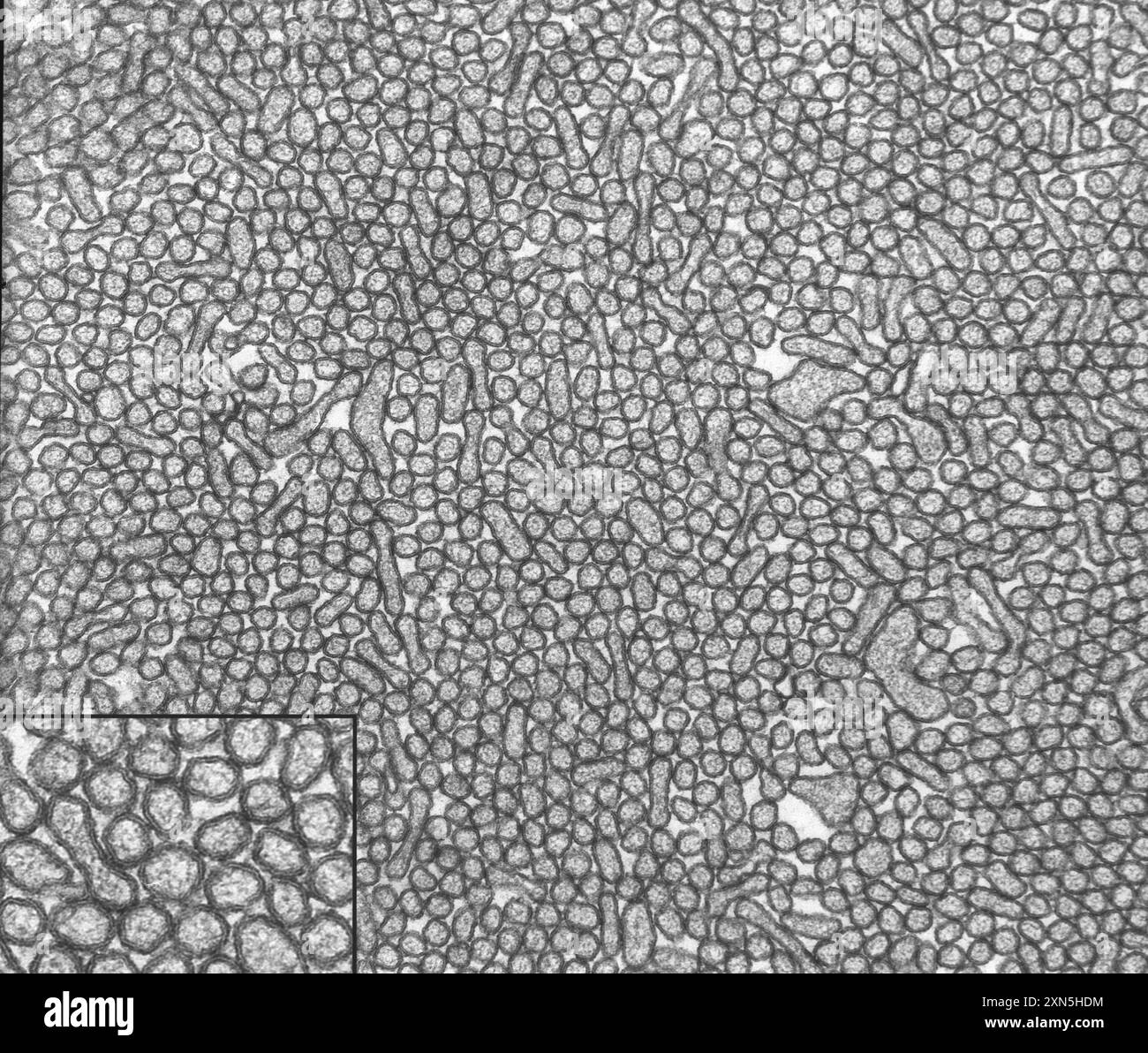 Transmission electron micrograph (TEM) showing a cross-sectioned brush ...