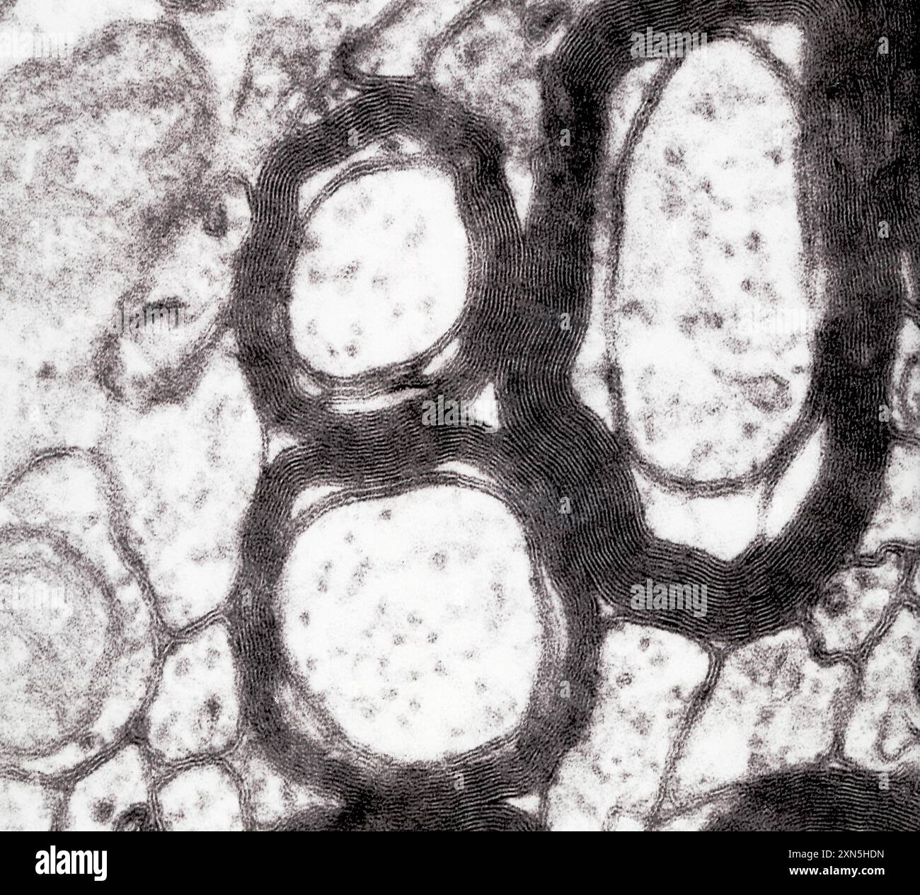 Transmission electron micrograph (TEM) of three central myelinated ...