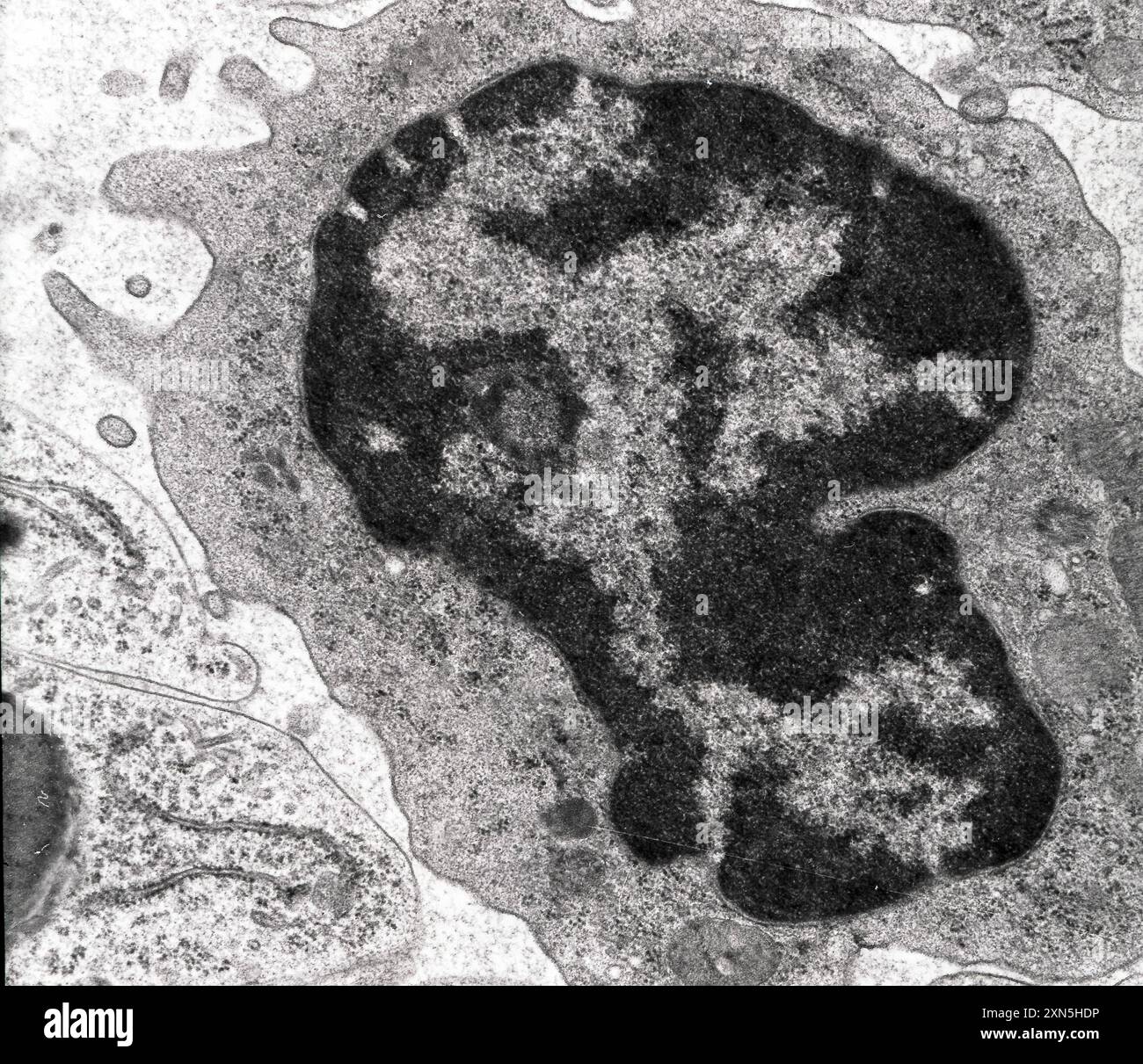 Transmission electron micrograph (TEM) showing a lymphocyte with small ...