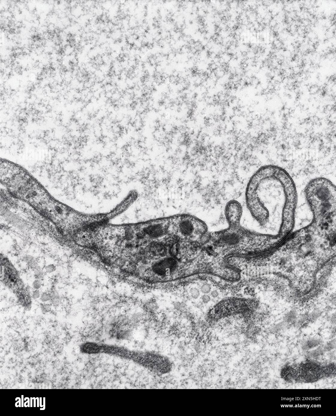 Transmission electron micrograph (TEM) showing the junctions among ...