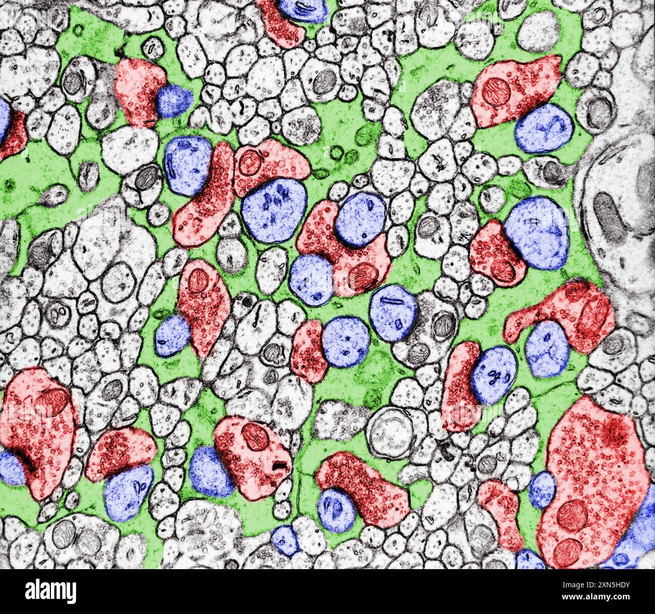 Coloured transmission electron micrograph (TEM) of the cerebellar molecular layer showing ...