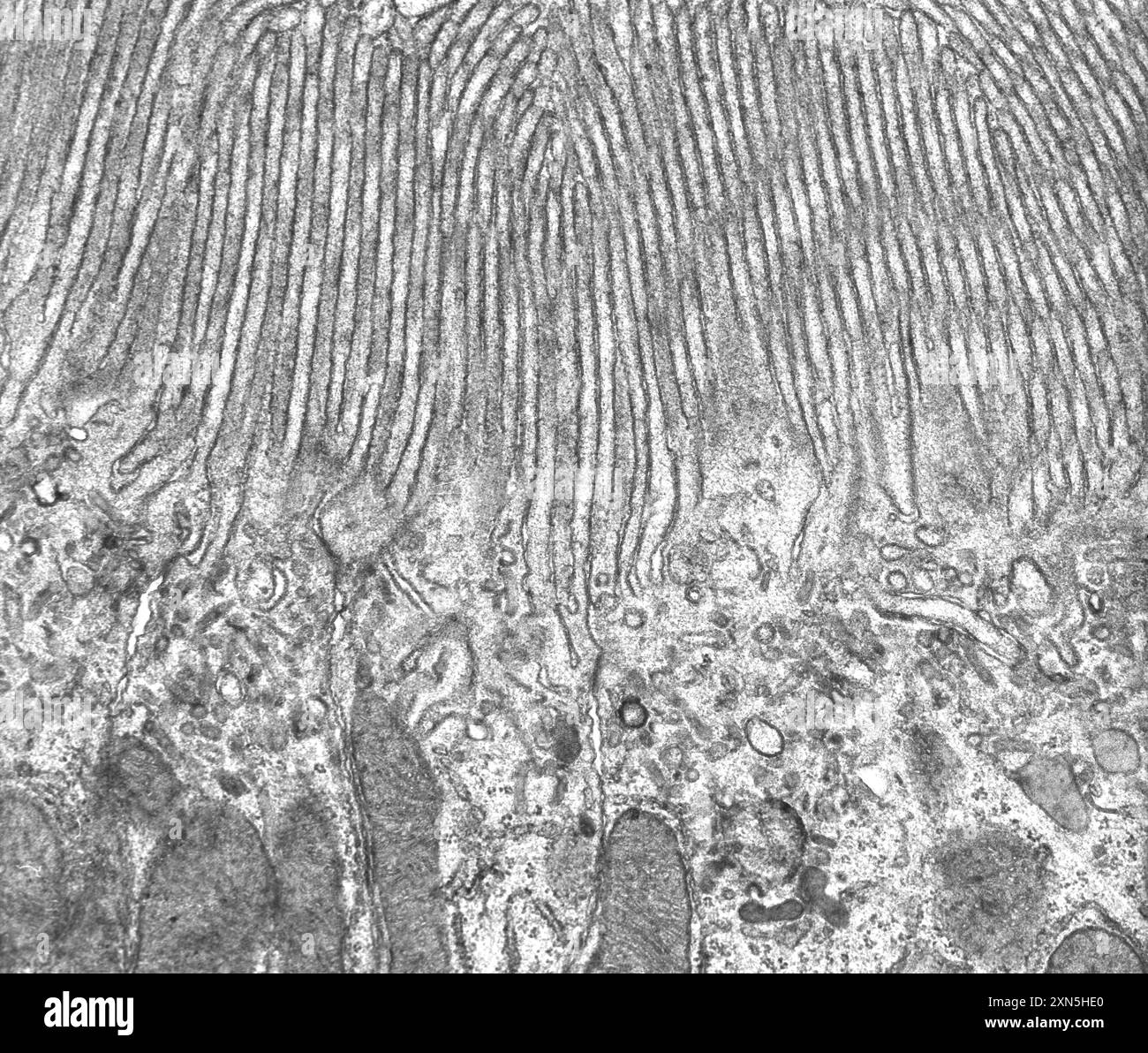 Transmission electron micrograph (TEM) of the brush border located in the apical surface of a ...