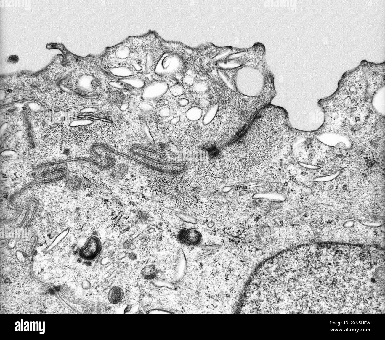 Transmission electron micrograph (TEM) of the intercellular junction ...