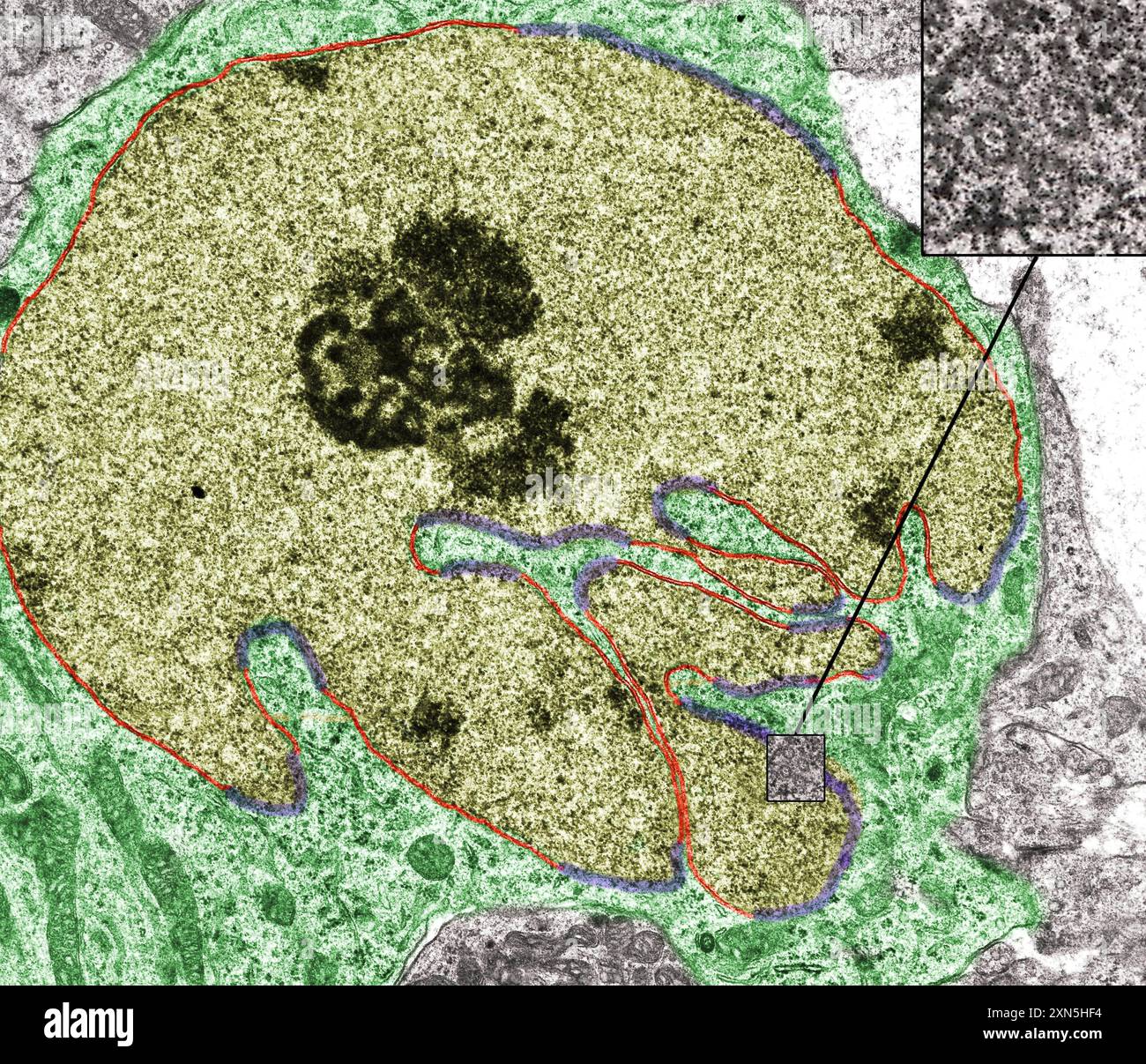 Coloured transmission electron micrograph (TEM) of a nucleus (yellow ...
