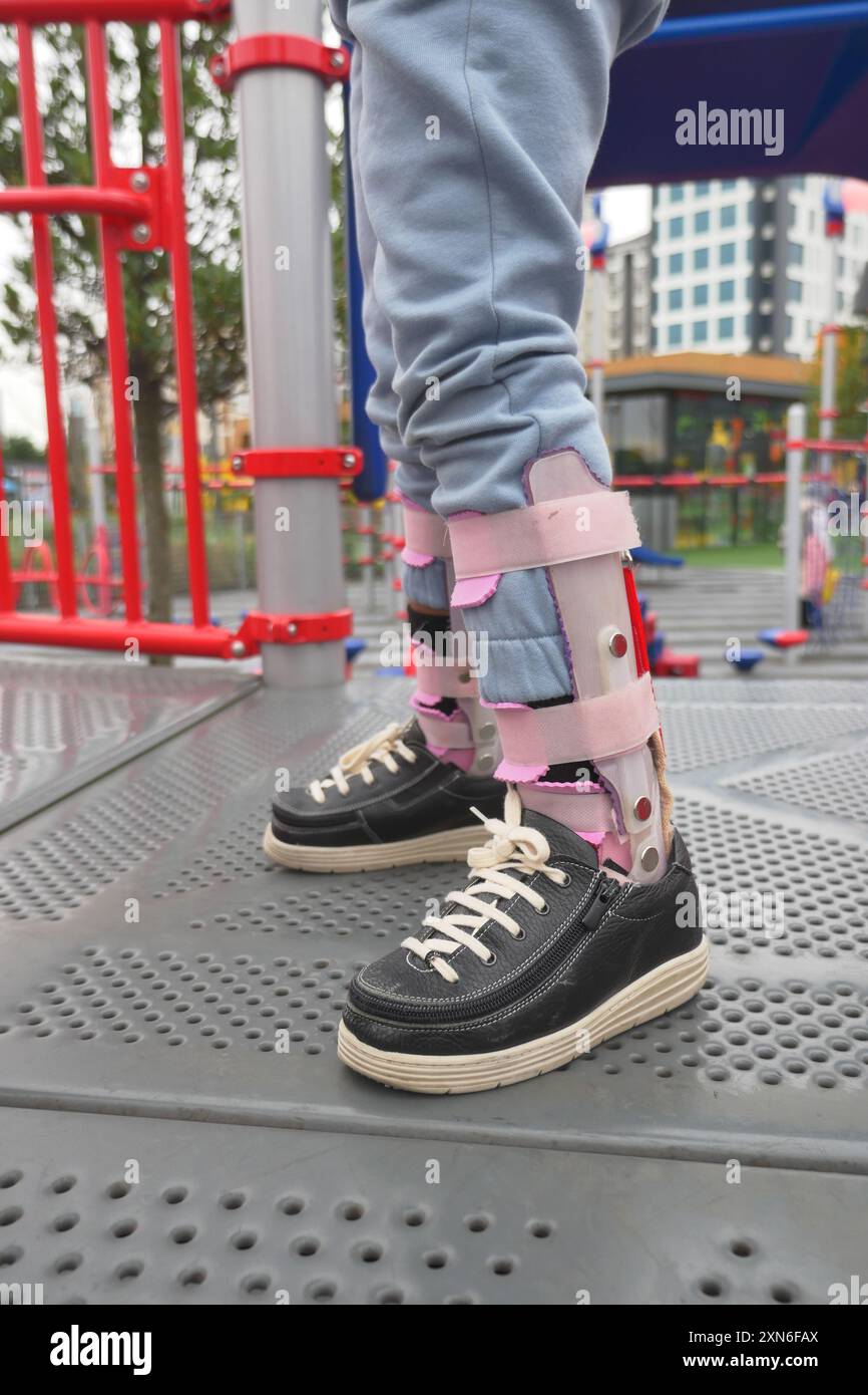 Child cerebral palsy disability legs hi-res stock photography and ...