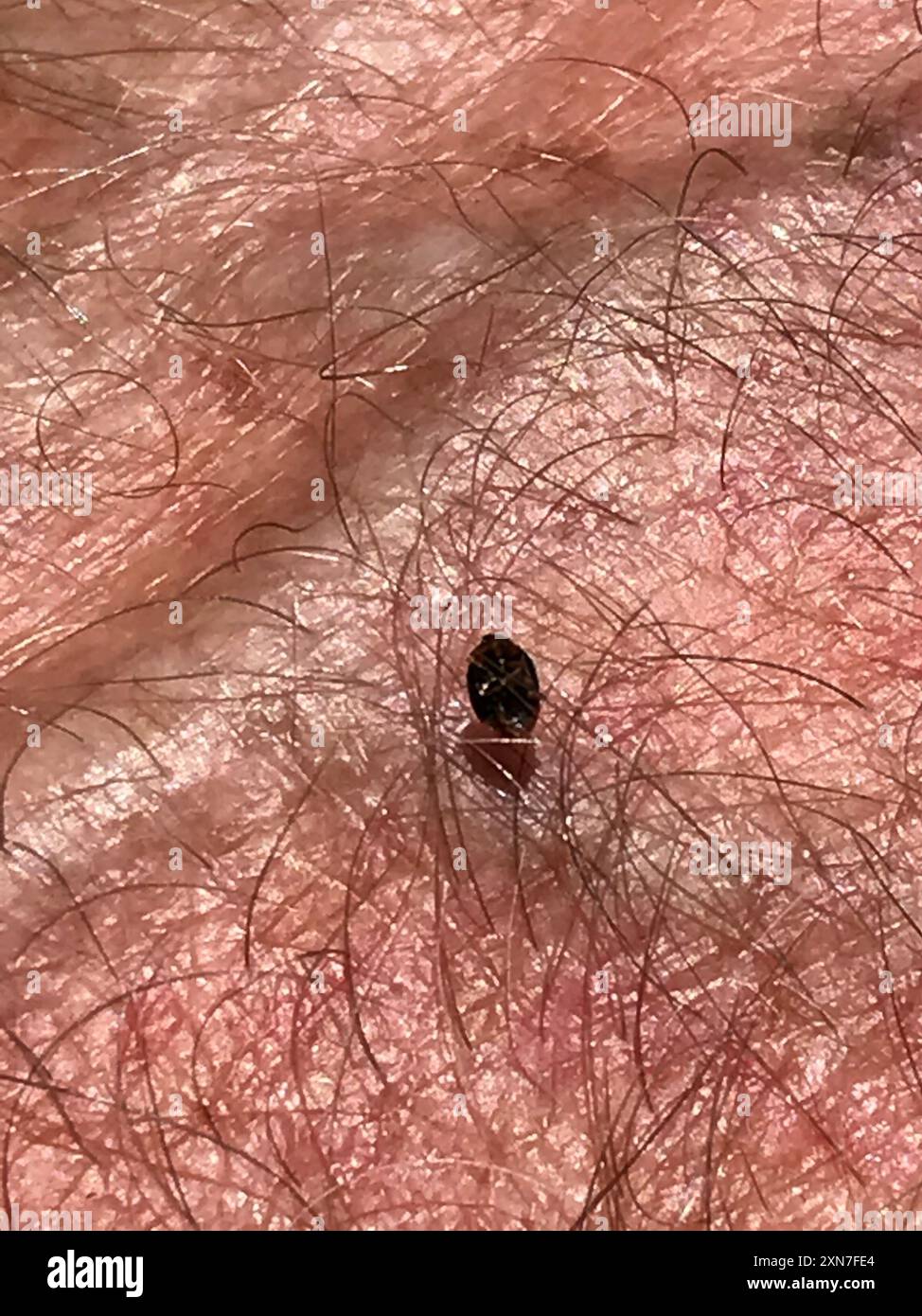 Lady, Fungus, Scavenger, and Bark Beetles (Coccinelloidea) Insecta ...