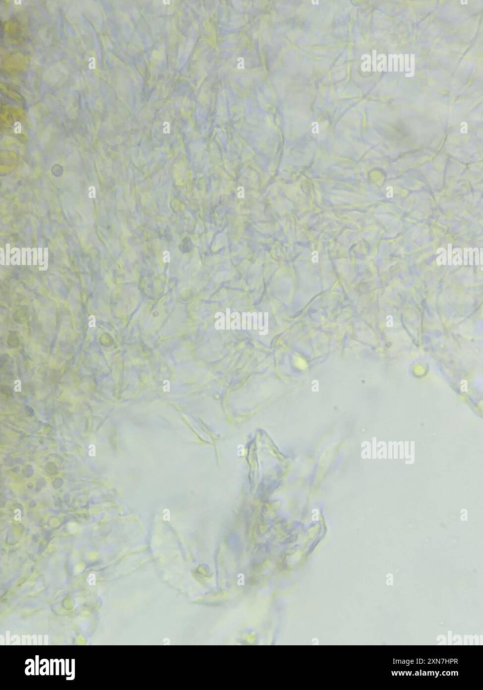 (Pseudolaccaria pachyphylla) Fungi Stock Photo - Alamy