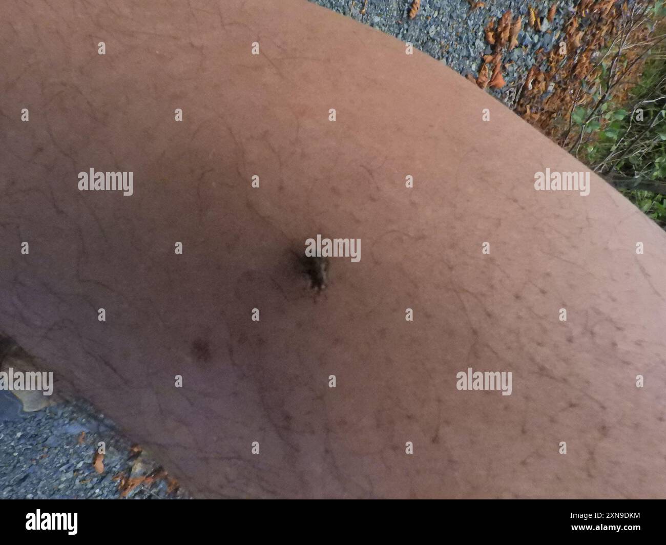 Stable Fly (Stomoxys calcitrans) Insecta Stock Photo - Alamy