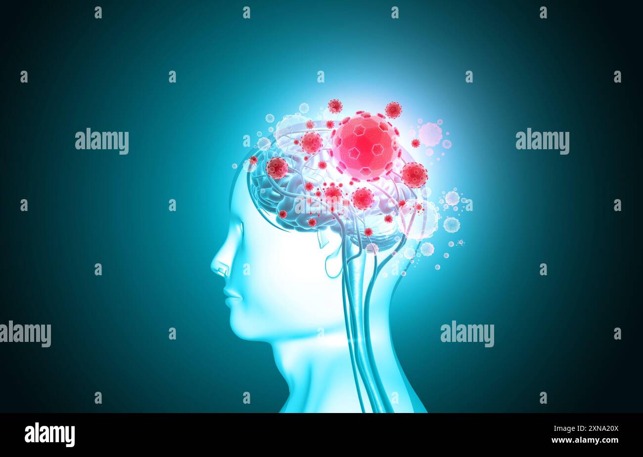 Virus attacking a human brain. male figure with brain and virus cells ...