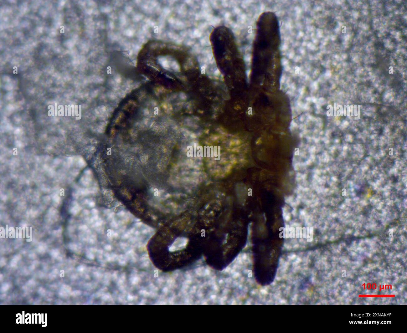 Mites and Ticks (Acari) Arachnida Stock Photo - Alamy