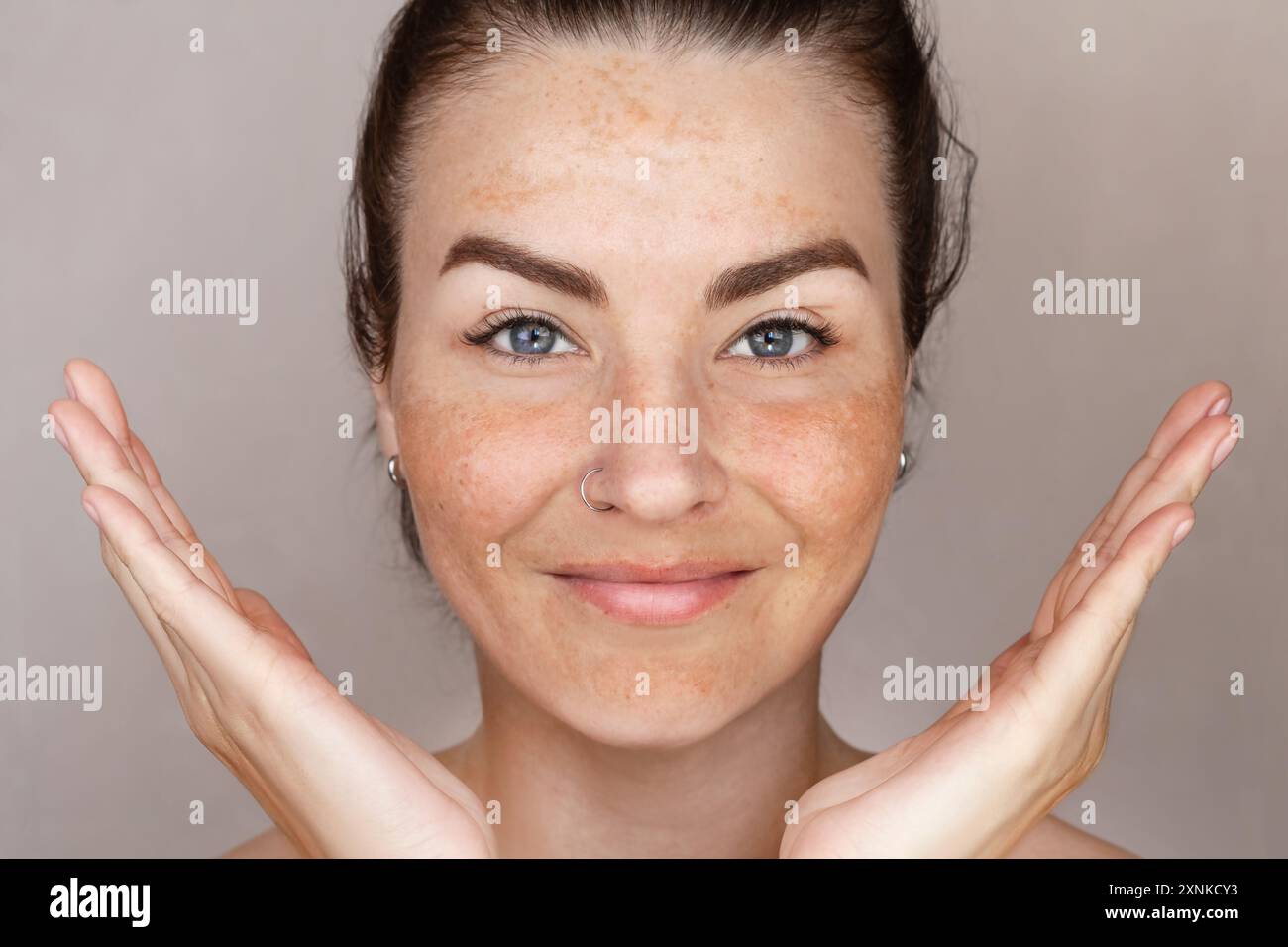 Sun spots face hi-res stock photography and images - Alamy