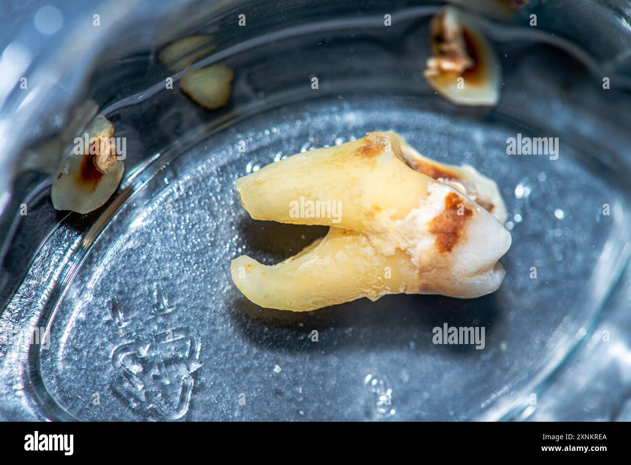 Examination of dental structure hi-res stock photography and images - Alamy