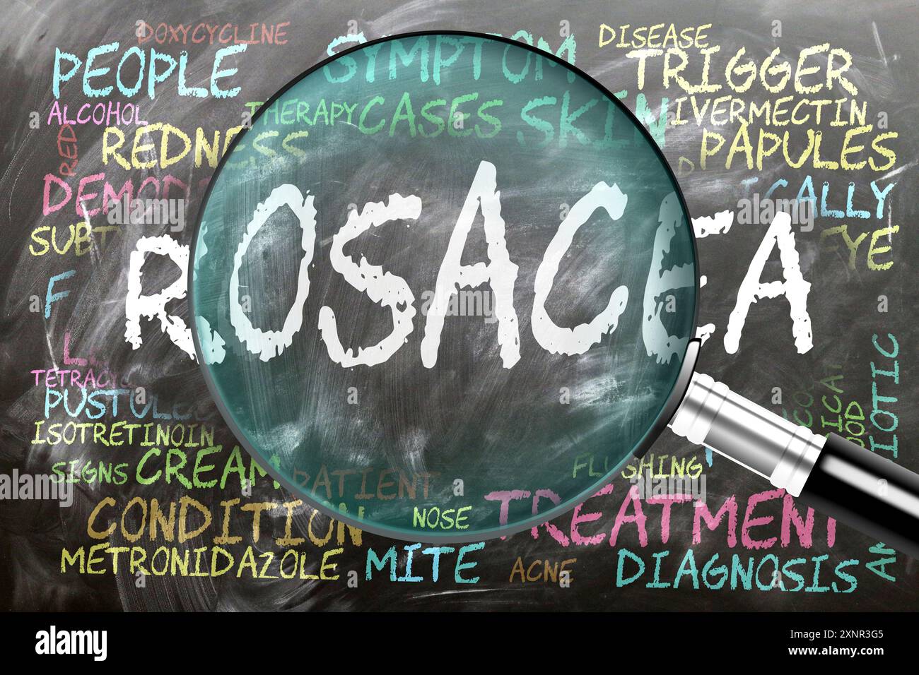 Rosacea under magnifying glass hi-res stock photography and images - Alamy