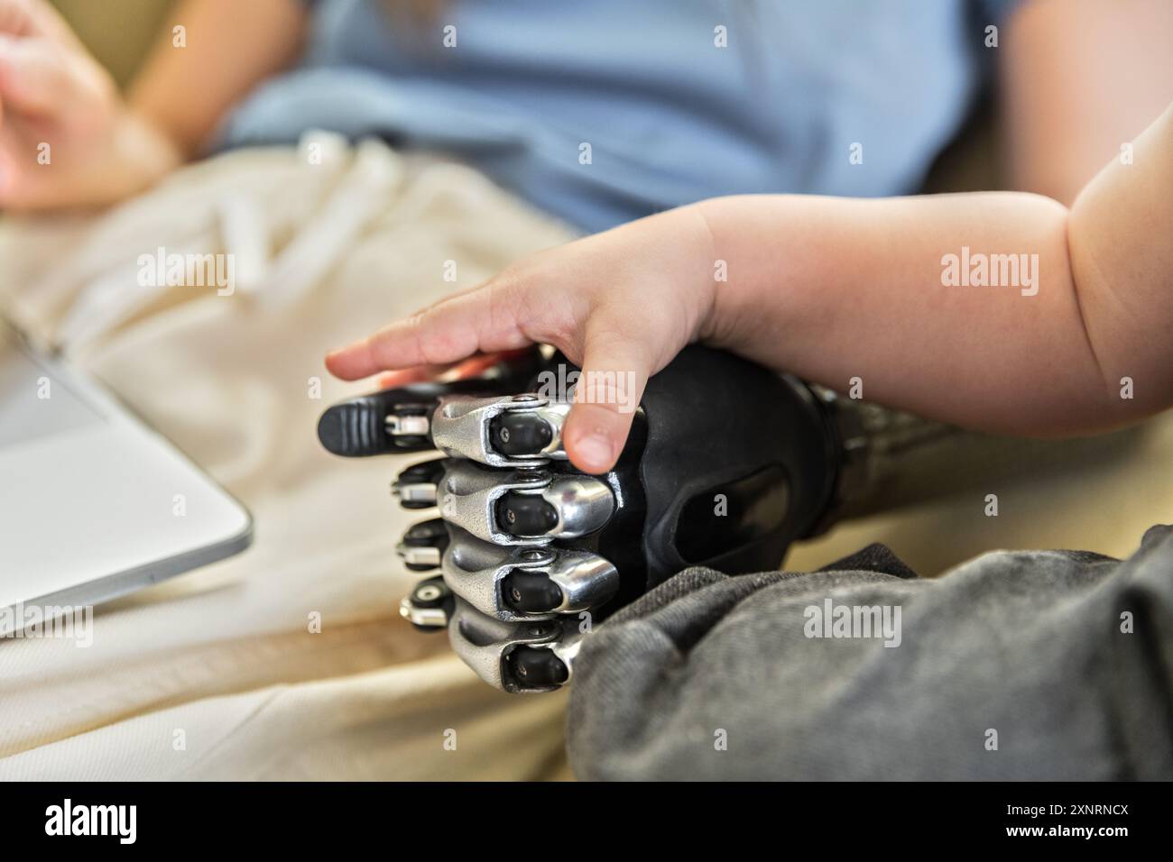 Prosthetic limb touch hi-res stock photography and images - Alamy