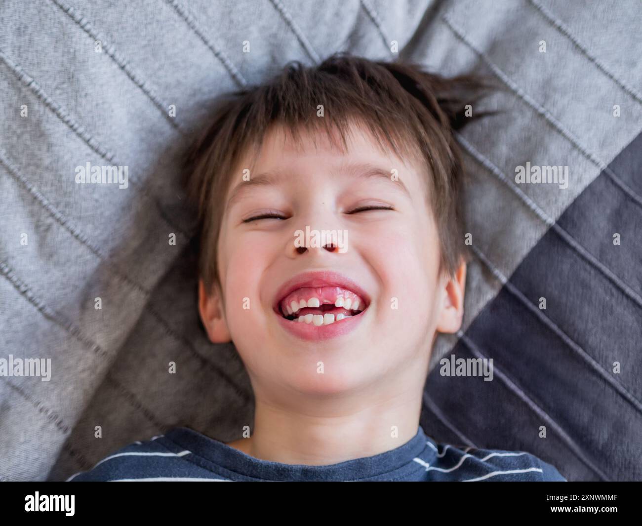 Laughing kid shows hole in row of teeth in his mouth. One incisor fell ...