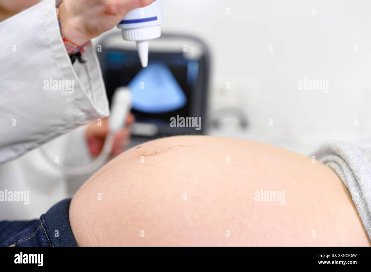 Doctor does Ultrasound or Sonogram Procedure to a Pregnant Woman in the ...