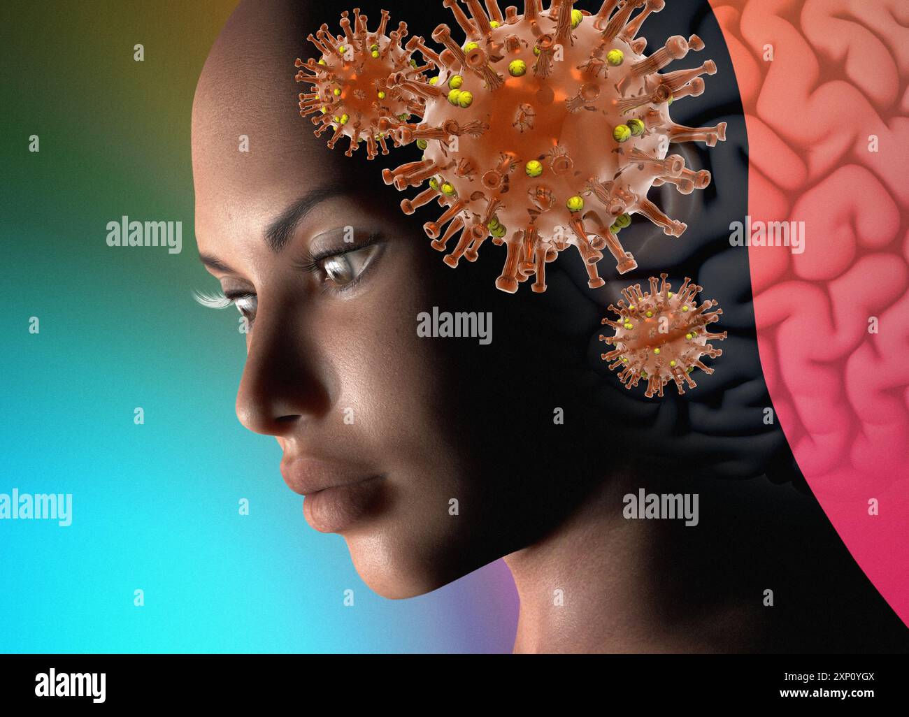 COVID-19 brain fog, conceptual illustration. Brain fog is one of the ...