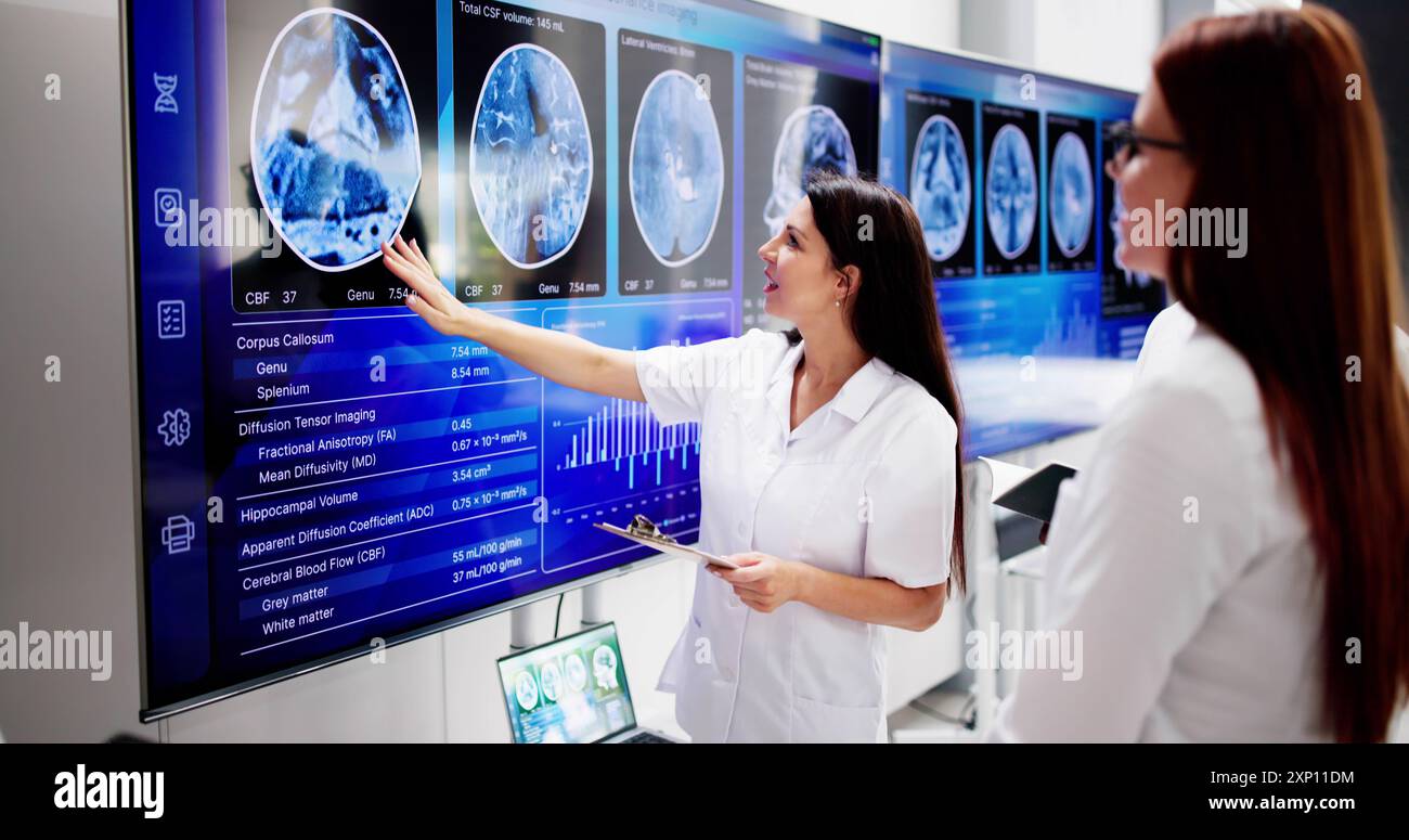 Doctors In Clinic Looking At Brain MRI Scan. Neurology Diagnosis Stock ...