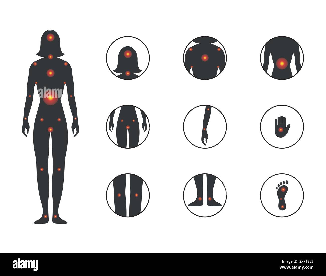 Point of female body pain. Injury icon set. Silhouette of a woman with ...
