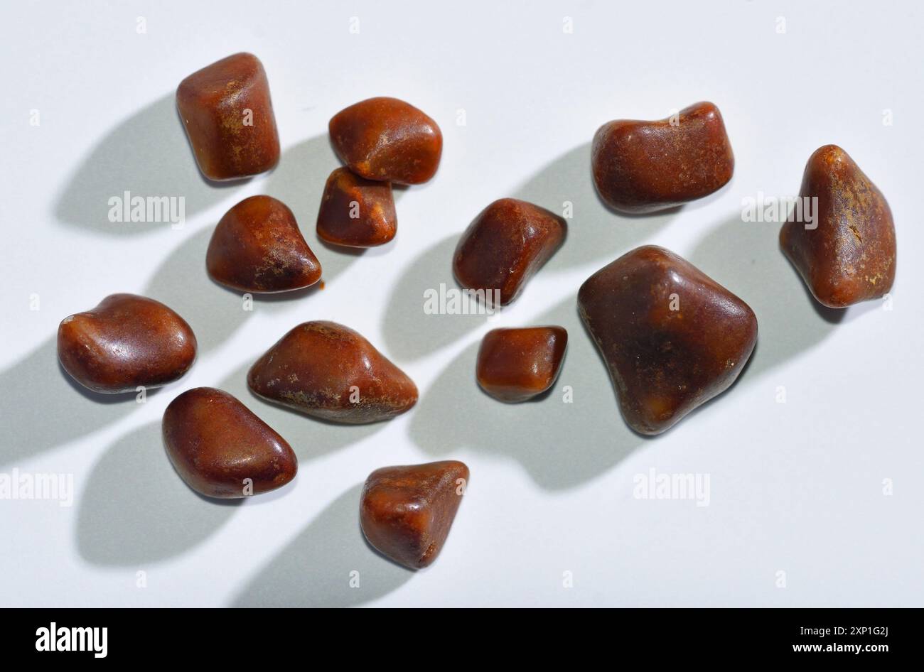 Gallstones hi-res stock photography and images - Alamy