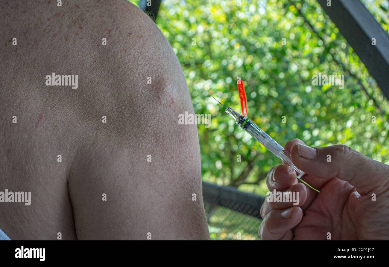 Shots, injection, syringe,hypo,hypodermic Stock Photo - Alamy