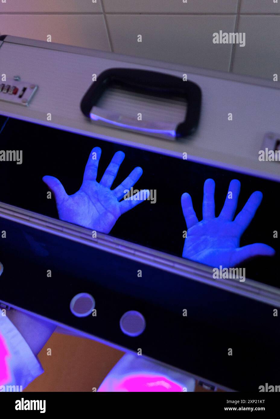 Ultraviolet examination of hands in a hygiene training kit, showcasing ...