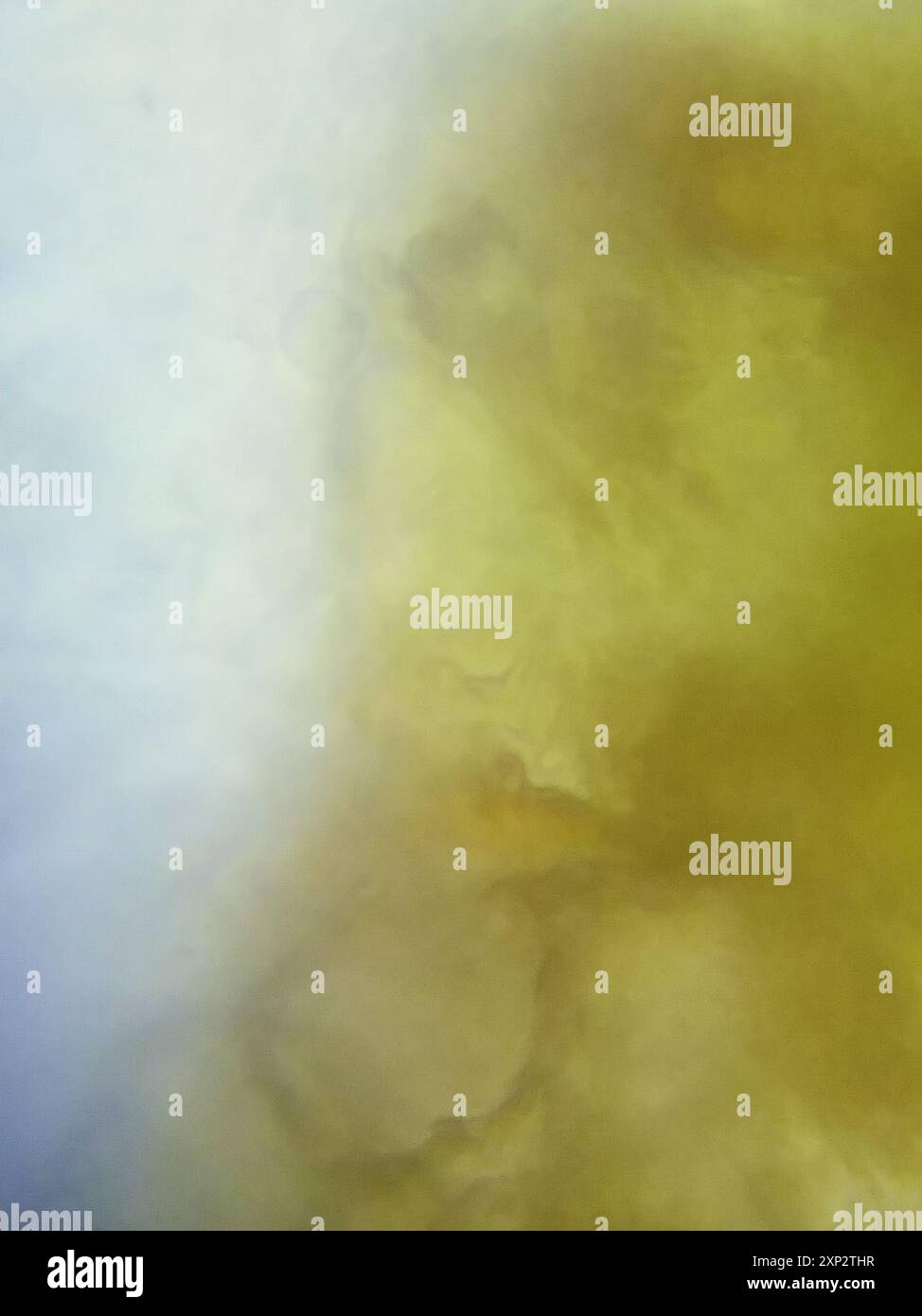 (Lycogala flavofuscum) Protozoa Stock Photo - Alamy