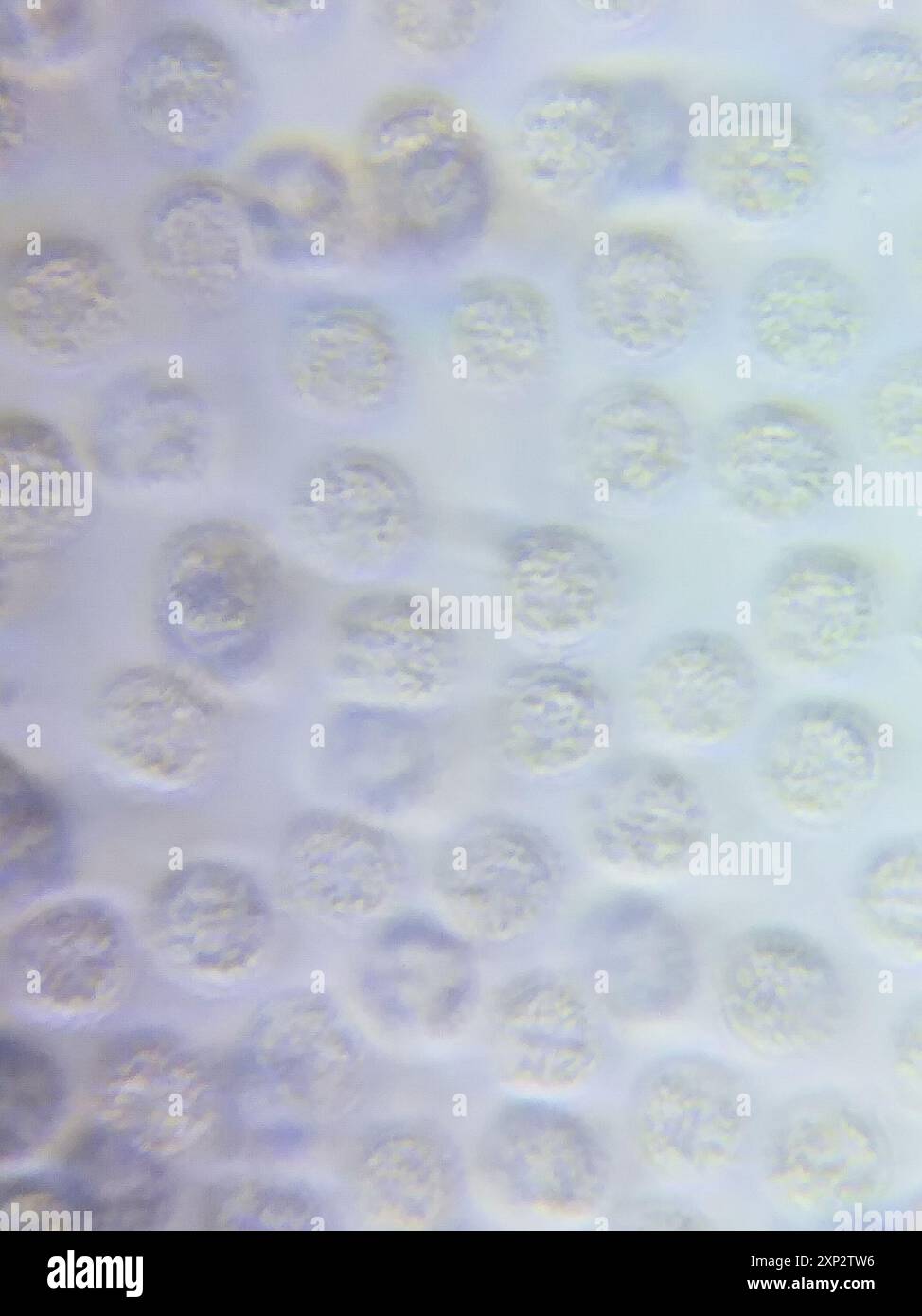 (Lycogala flavofuscum) Protozoa Stock Photo - Alamy