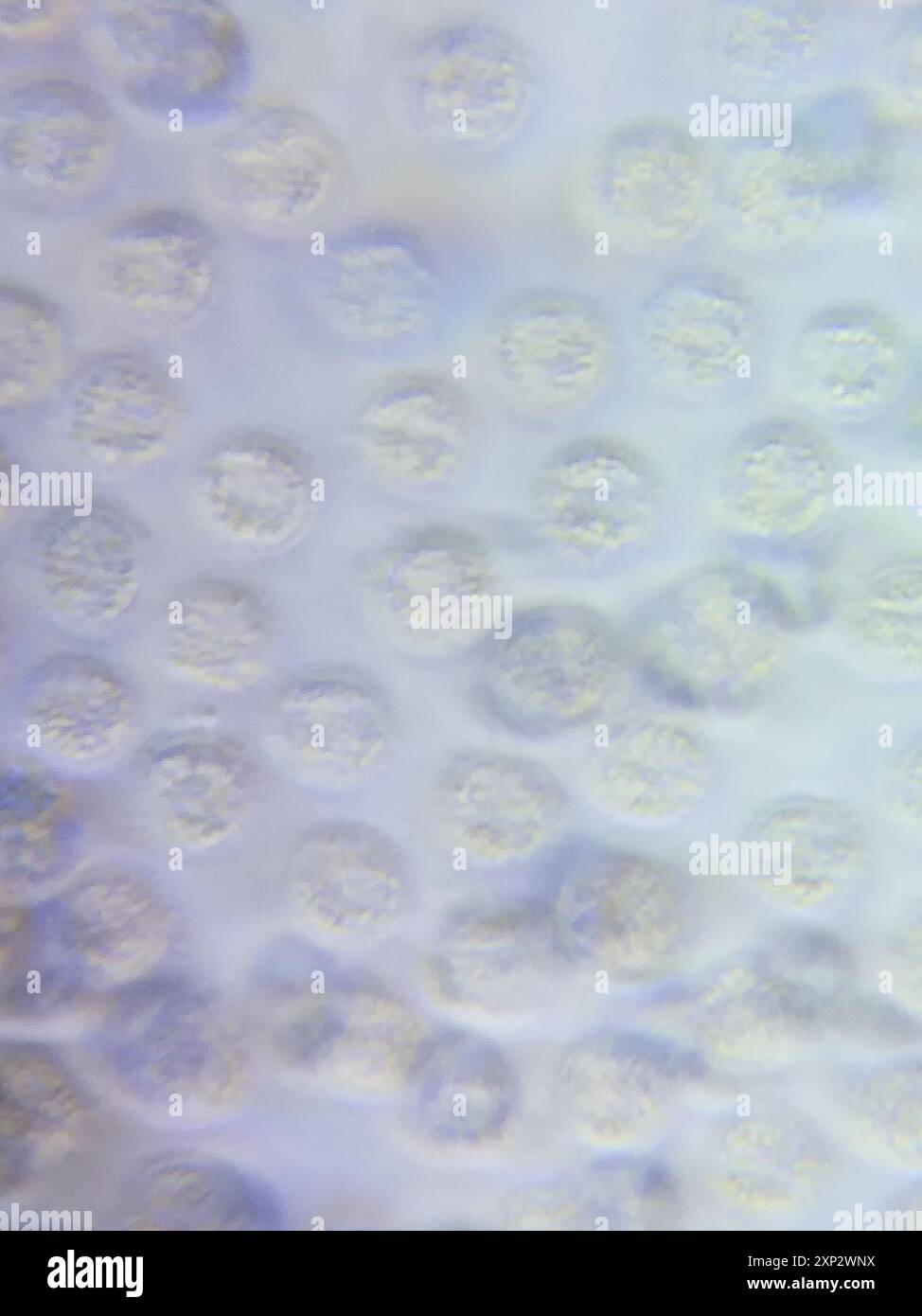 (Lycogala flavofuscum) Protozoa Stock Photo - Alamy