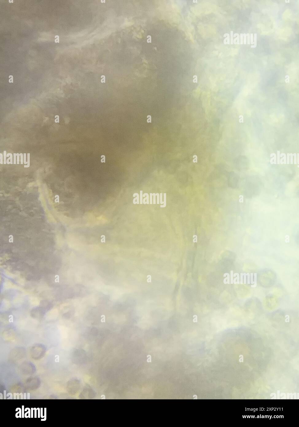 (Lycogala flavofuscum) Protozoa Stock Photo - Alamy