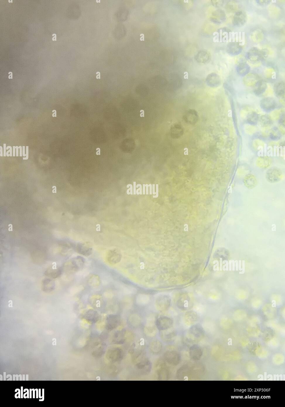 Lycogala flavofuscum hi-res stock photography and images - Alamy