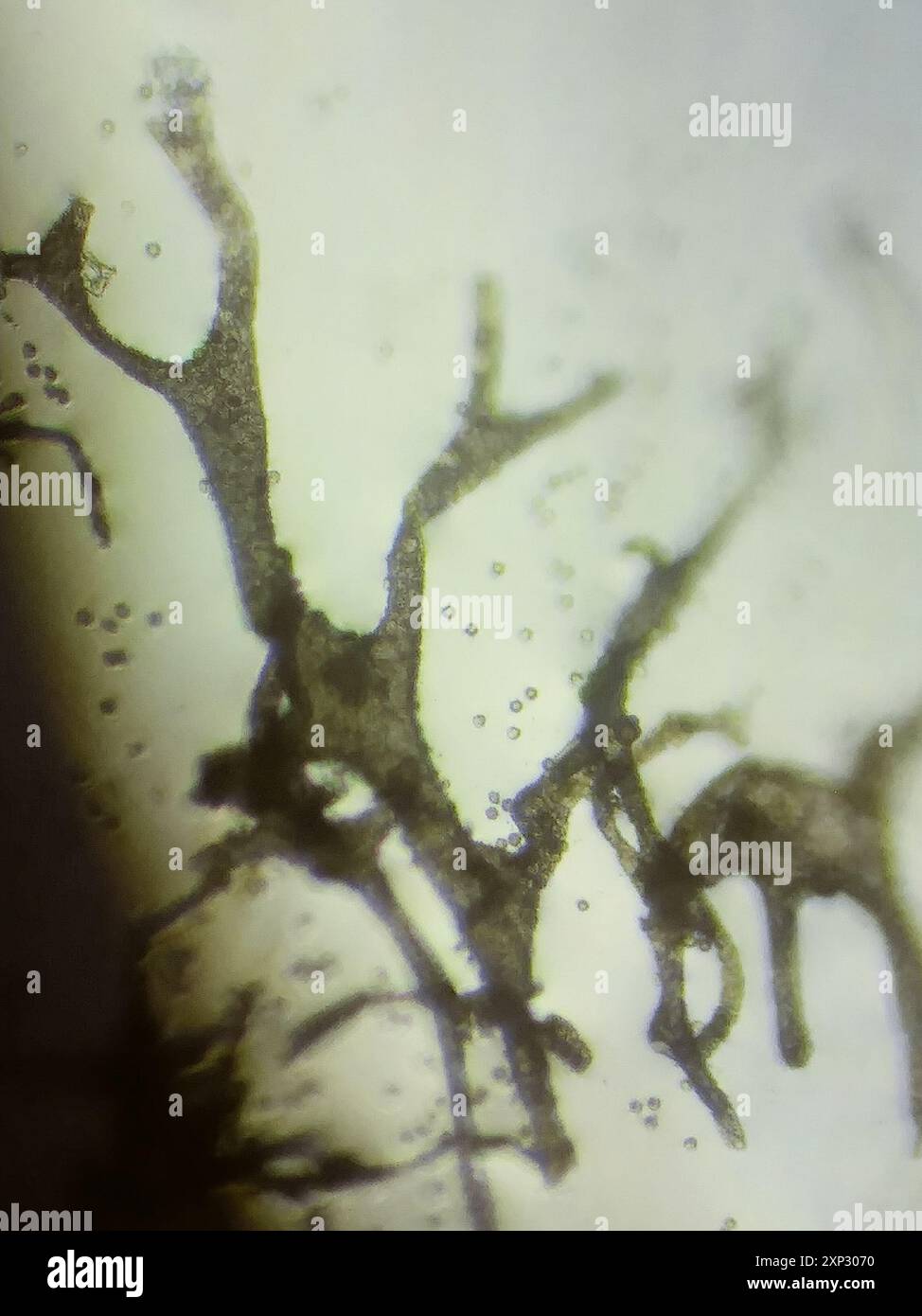 (Lycogala flavofuscum) Protozoa Stock Photo - Alamy