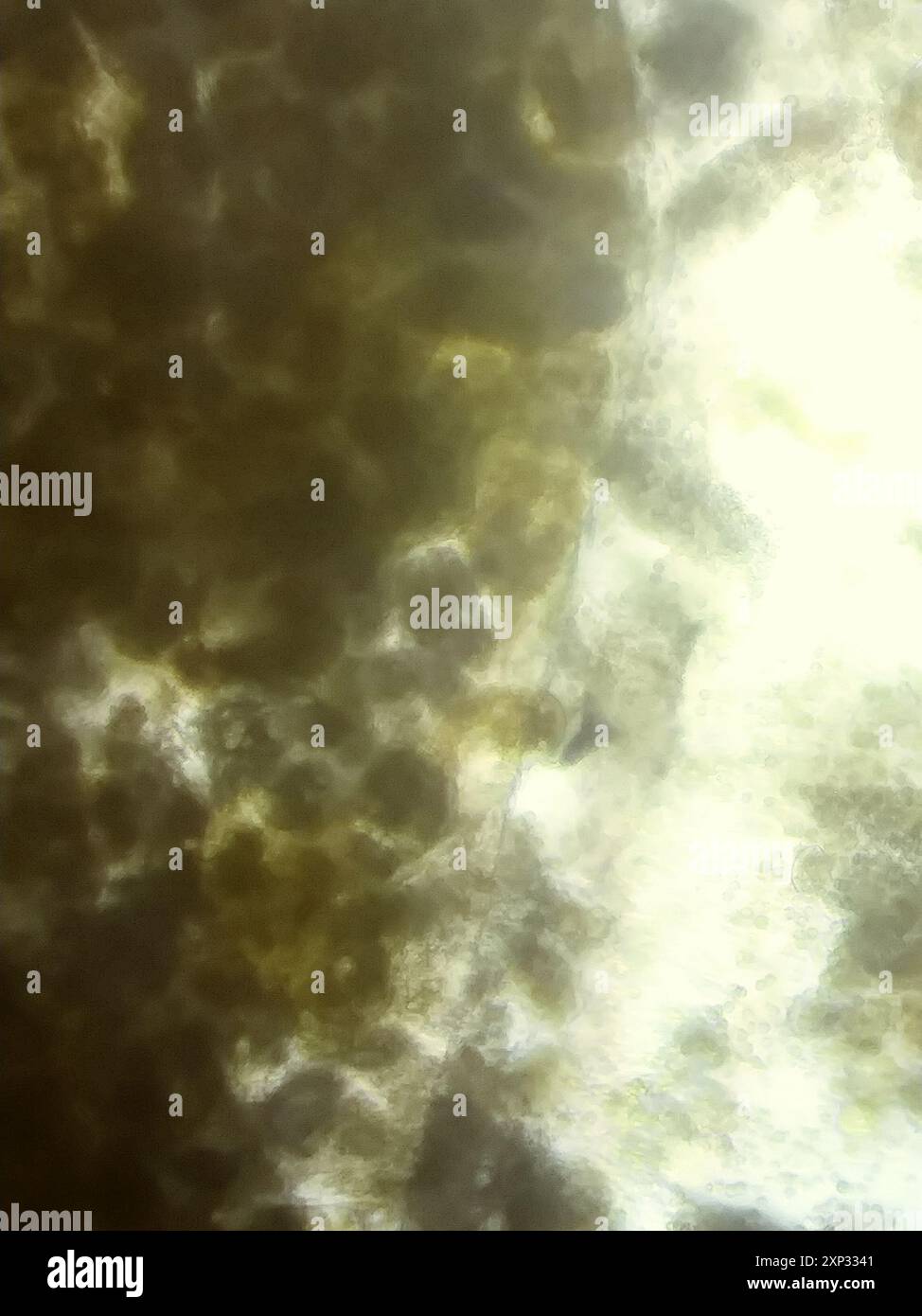 (Lycogala flavofuscum) Protozoa Stock Photo - Alamy