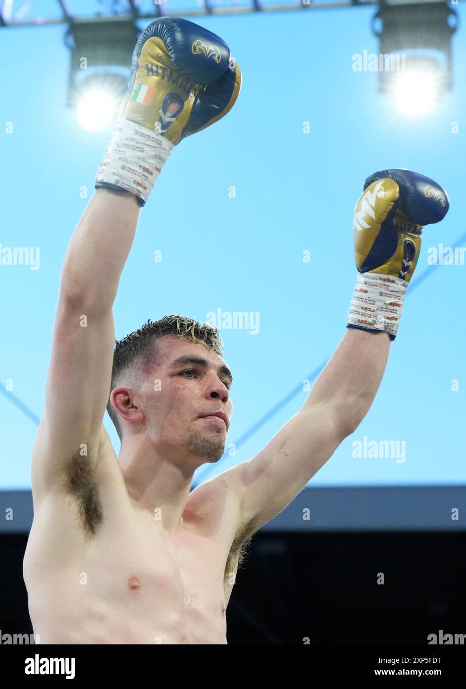 Stephen McKenna celebrates his win over Joe Laws after their WBC ...