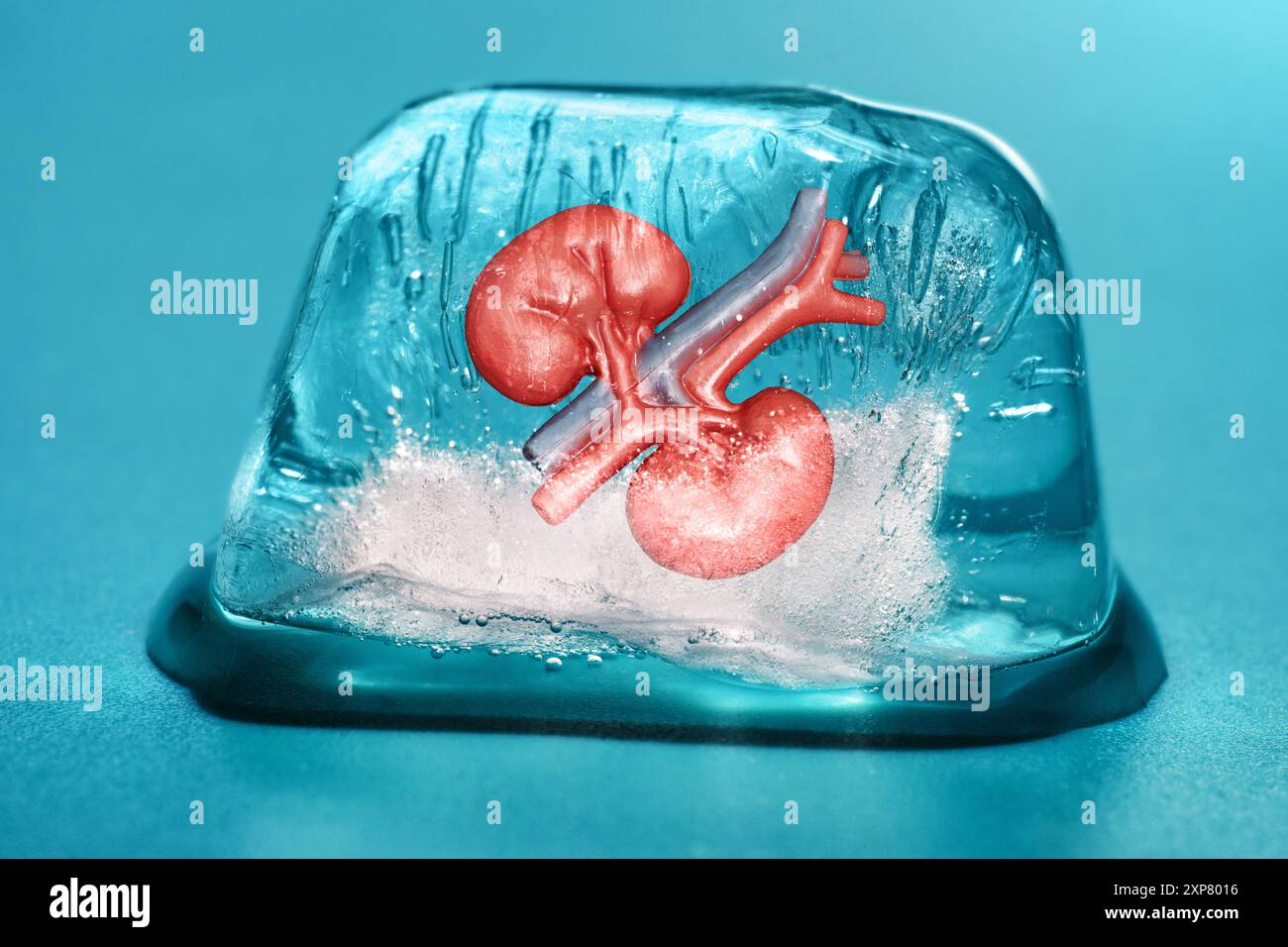 Close-up of a kidney model frozen in ice, illustrating detailed anatomy ...