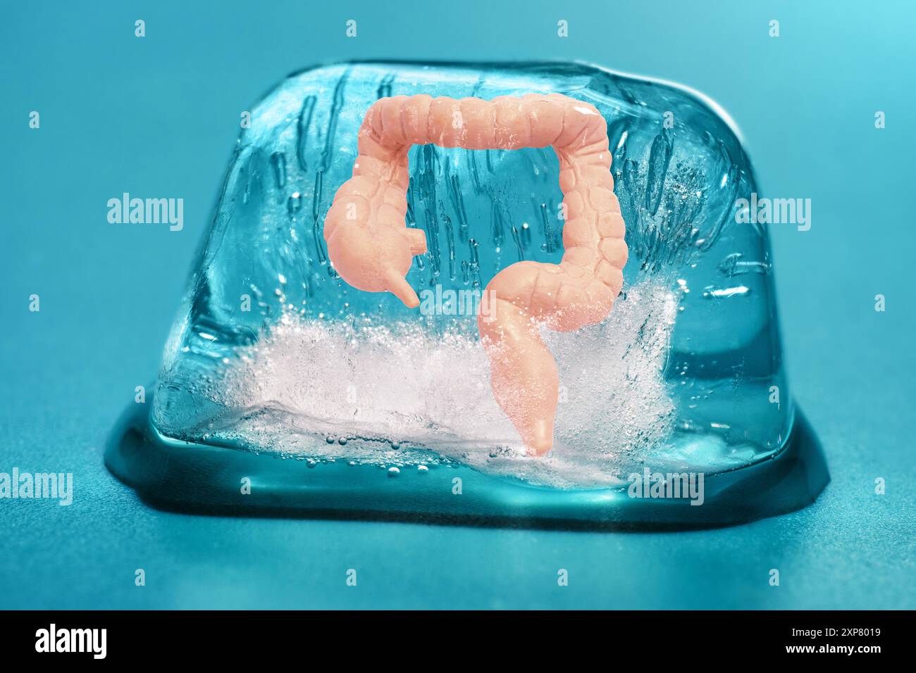 Human intestines model encapsulated in ice, emphasizing anatomy. Ideal ...